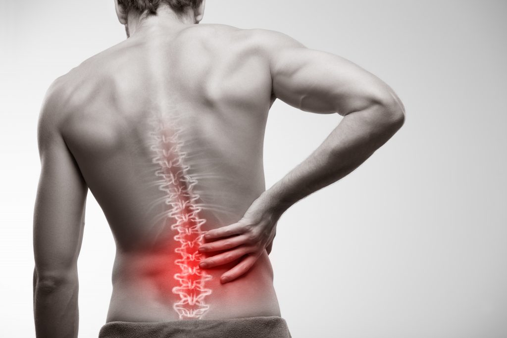 Facet Joint Disease - Precision Spine & Pain Management